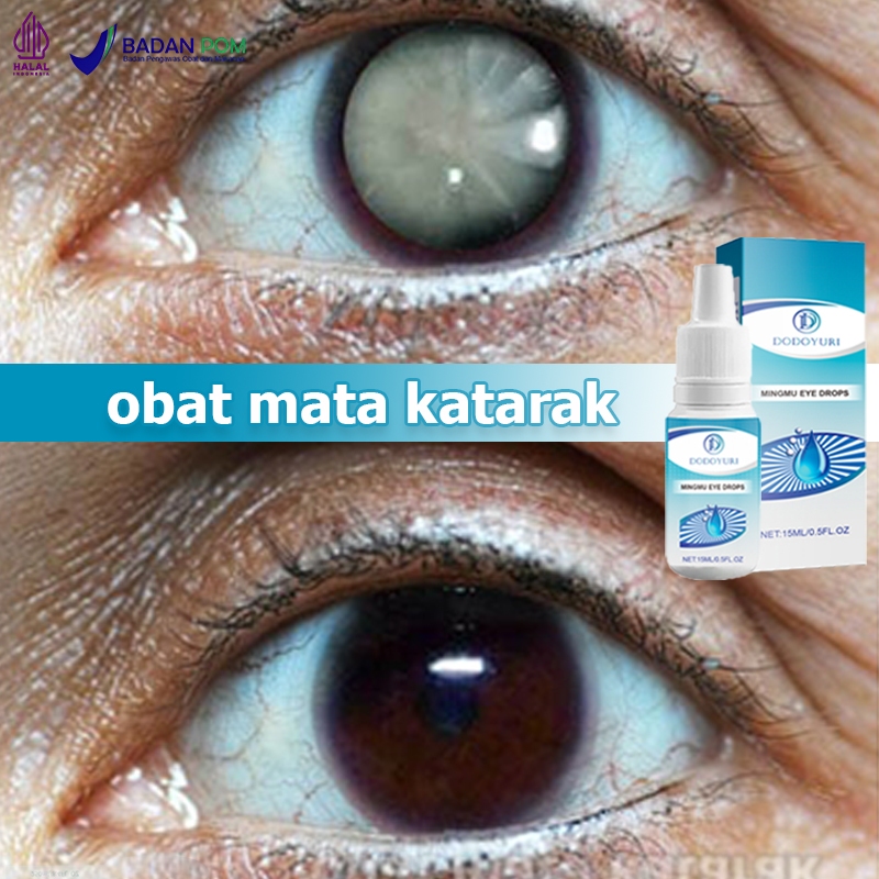 Jual Obat mata katarak Obat mata minus Obat tetes mata Tetes mata 15ml ...