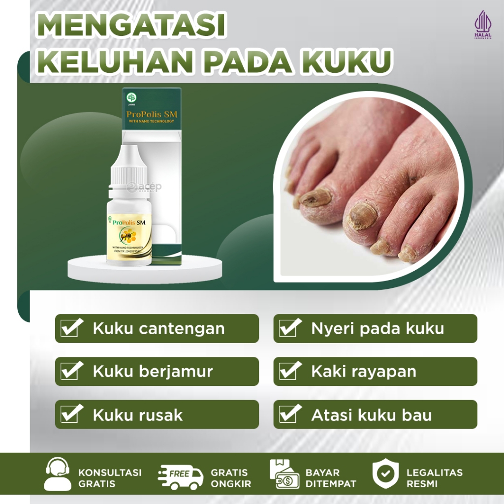 Jual Obat Jamur Kuku Cantengan Jempol Kaki Propolis SM Kuku Rusak ...