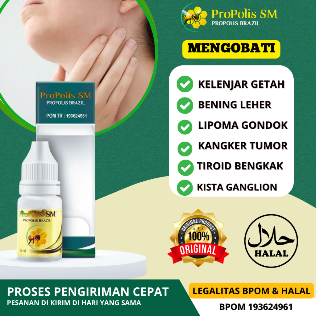 Jual Obat Gondok Beracun Tiroid Di Dalam Leher Gondokan Dan Benjolan ...