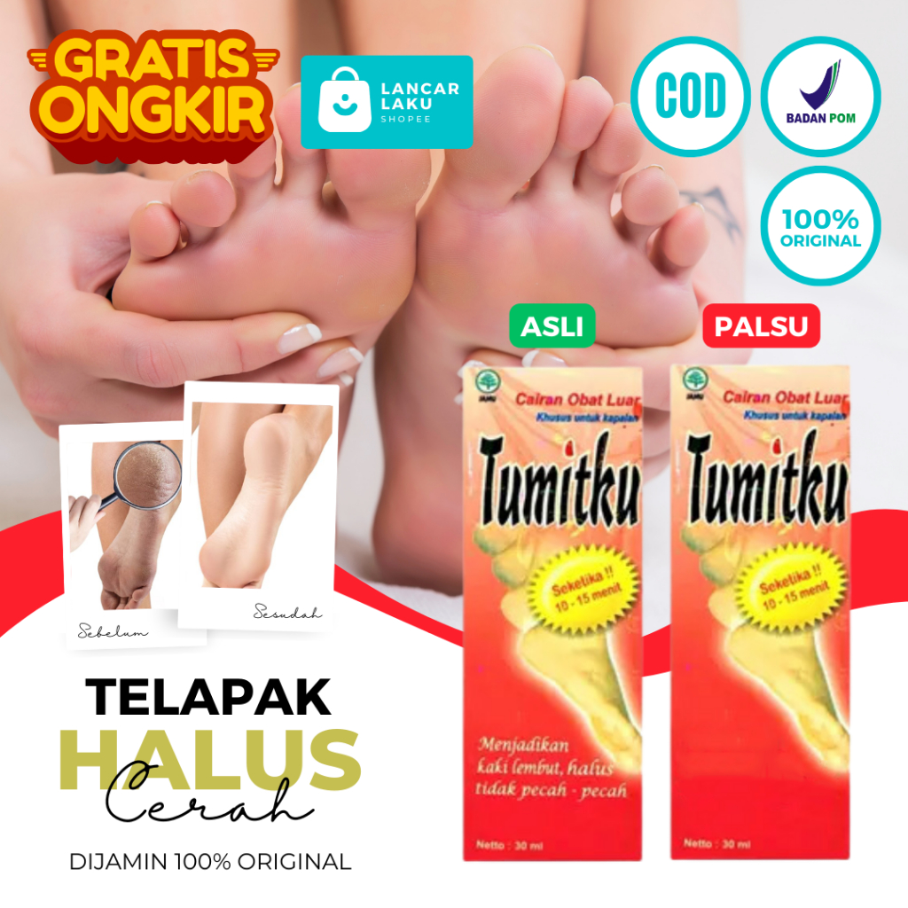 Jual [ASLI] Tumitku Obat Kaki Pecah Original - Obat Kaki Pecah Pecah ...