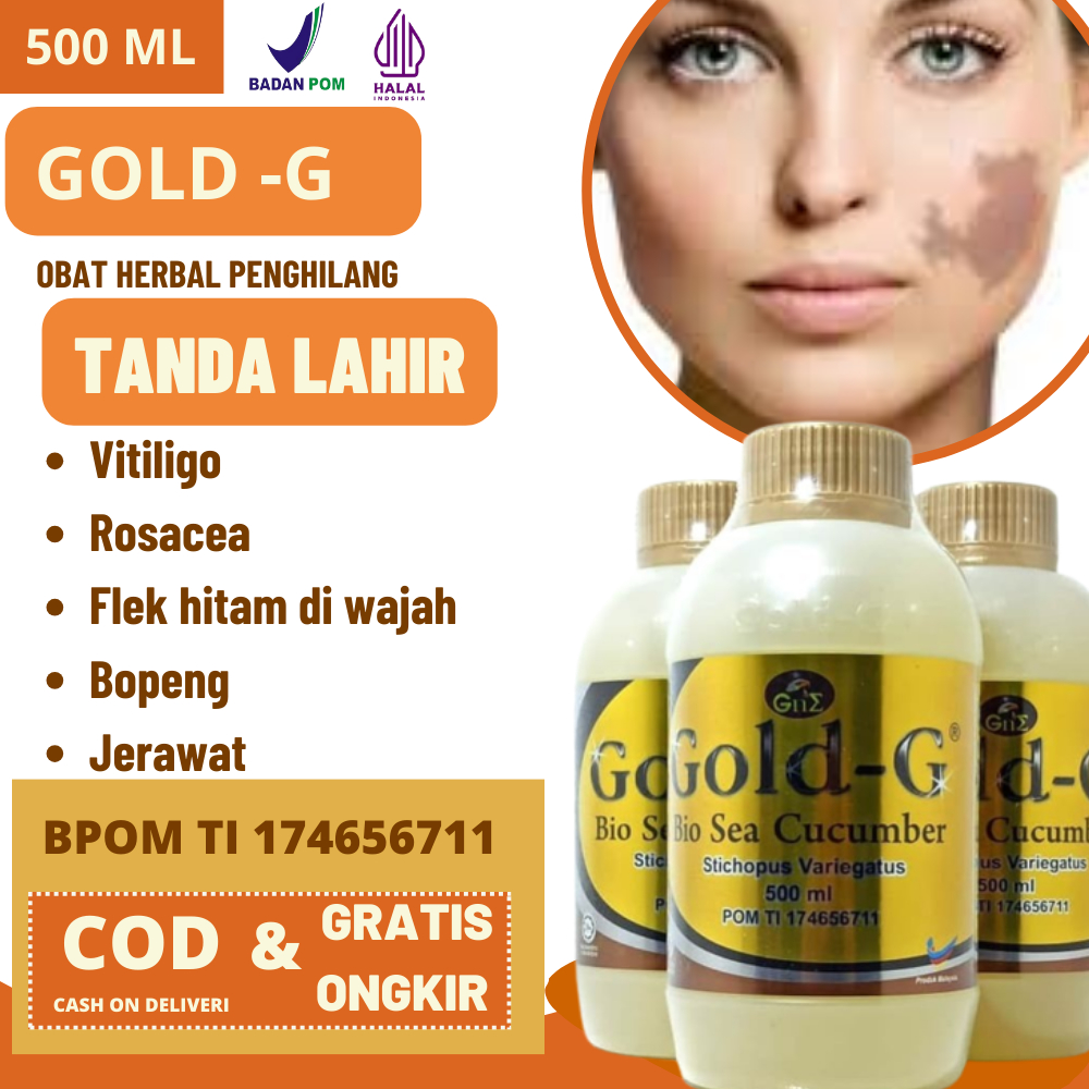 Jual BISA COD - Obat Cream Penghilang Tanda Lahir Coklat, Merah, Tompel ...