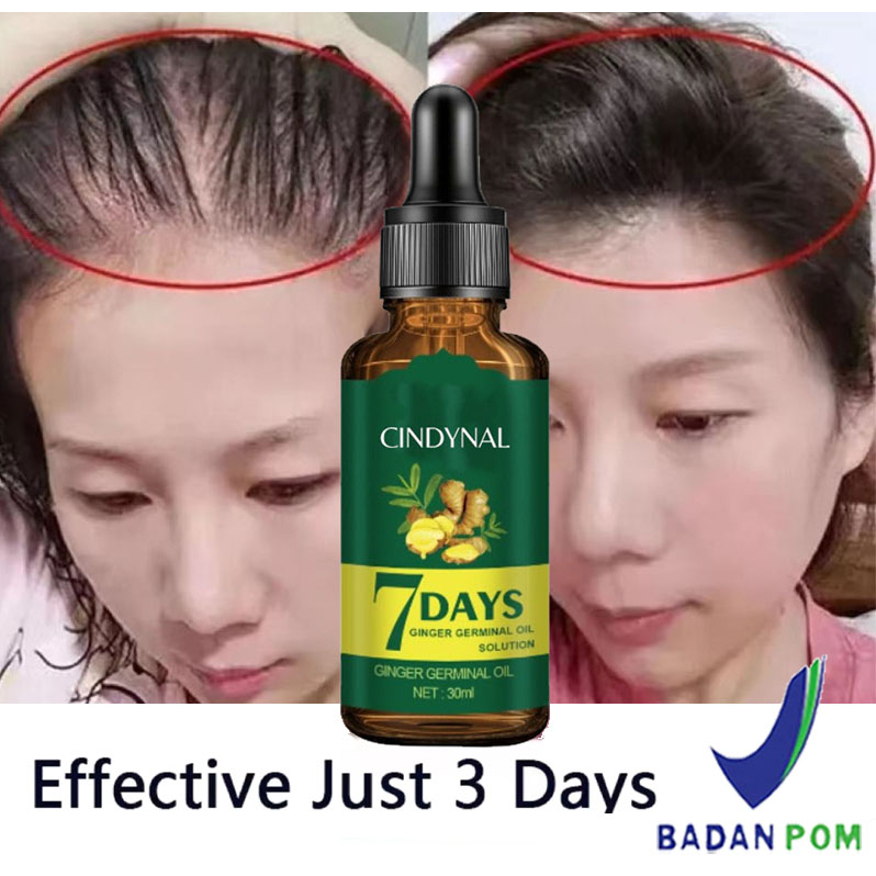 Jual Serum 7 Days Hair Tonic Ginseng Rambut Rontok Ampuh Menumbuhkan ...
