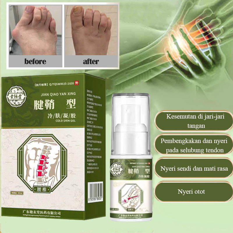 Jual Obat Tenosinovitis Spray Obat Tulang Dan Sendi Kompres Dingin Semprotan Tendonitis Sendi ...