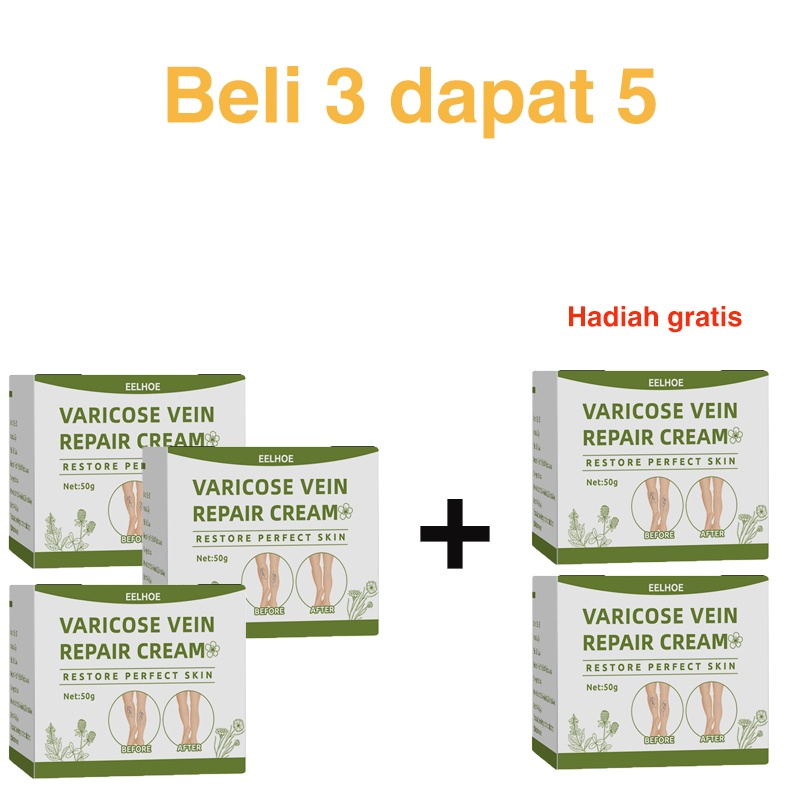 Jual Obat Varises Salep Varises Cream Varicose Veins Varikokel Bengkak ...