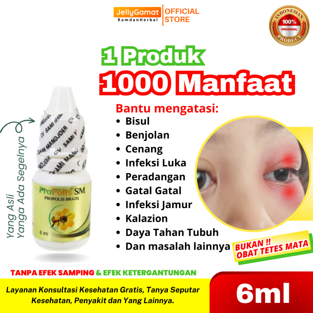Jual Obat Bisul Di Kelopak Mata Jerawat Di Kelopak Mata Obat Bintitan ...