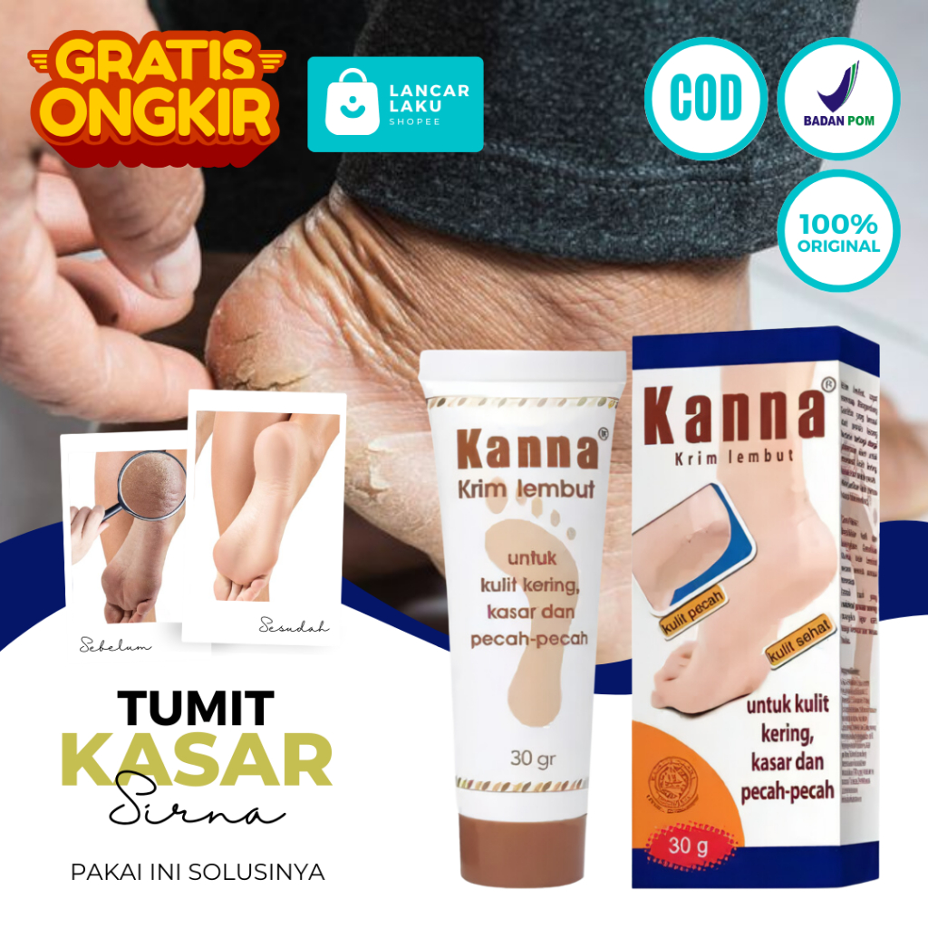Jual [ORIGINAL] Kanna Cream Kaki - Obat Krim Kaki Pecah Pecah Dan ...