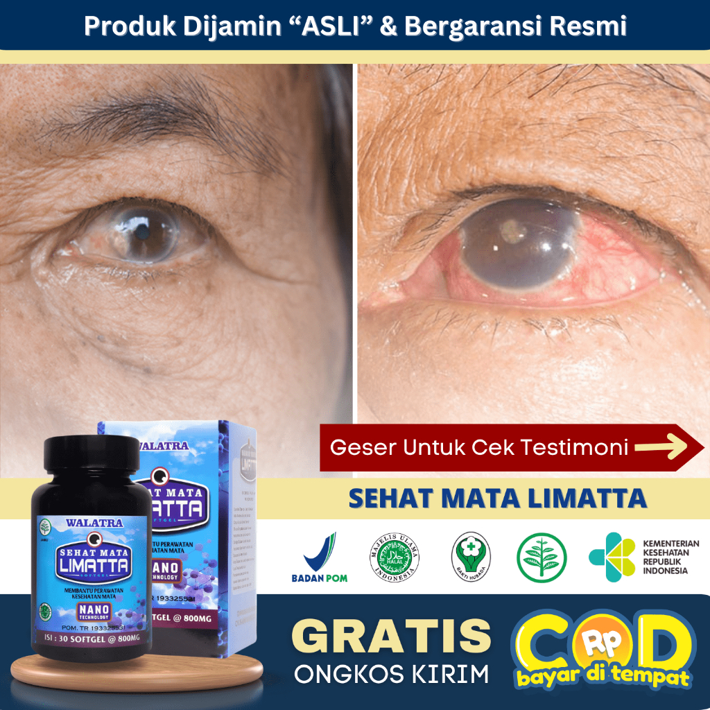 Jual Obat Mata Katarak, Obat Glaukoma, Glukoma - Sehat Mata LIMATTA ...