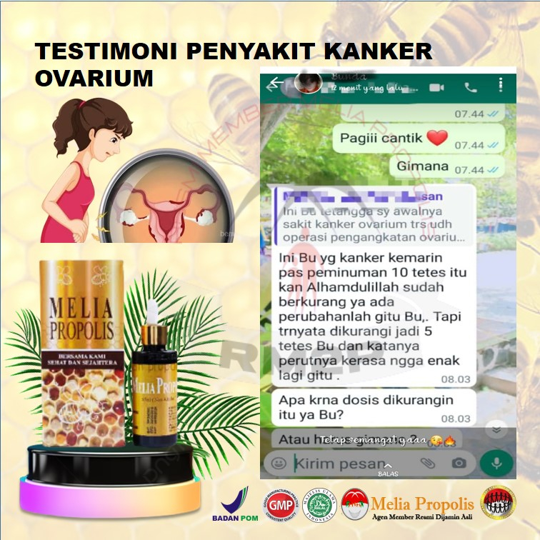 Jual Propolis Obat Kankar Ovarium Kista Stadium 1 2 3 4 Tumor Tanpa ...