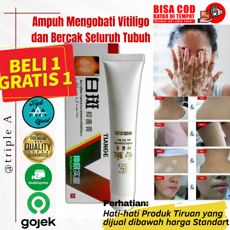 Jual TRIPLE A - Obat Panu Obat Vitiligo Salep Vitiligo Penghilang ...