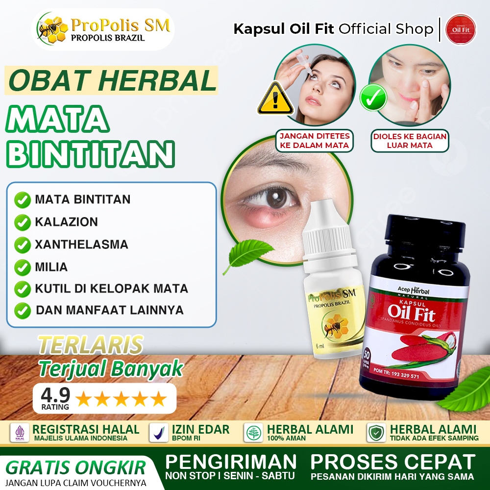 Jual Obat Benjolan Di Kelopak Mata Timbilan Mata Bintitan Kalazion ...