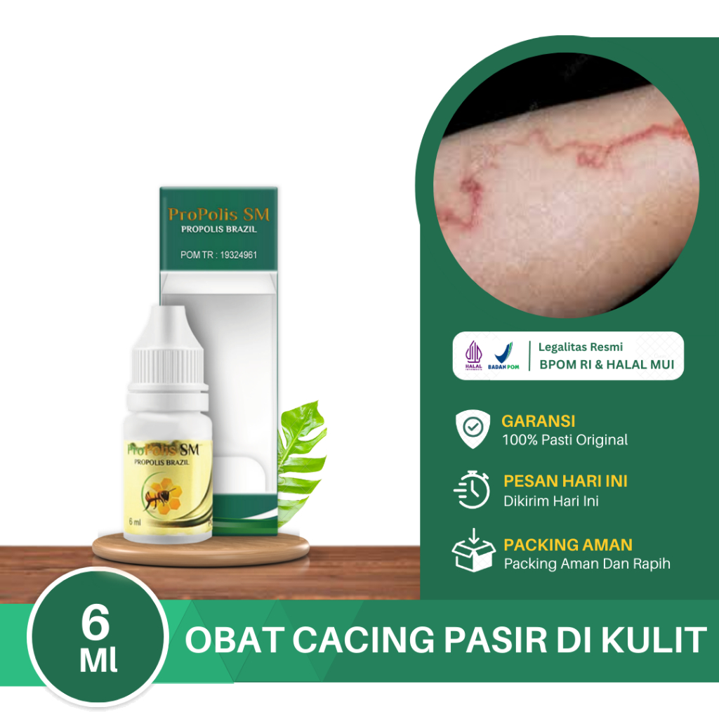 Jual Obat Cacing Pasir, Cacing Pasir Di Kulit, Cacing Tambang, Infeksi ...