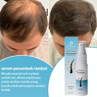 Jual obat penumbuh rambut botak Harga Terbaik & Termurah Juni 2024 ...