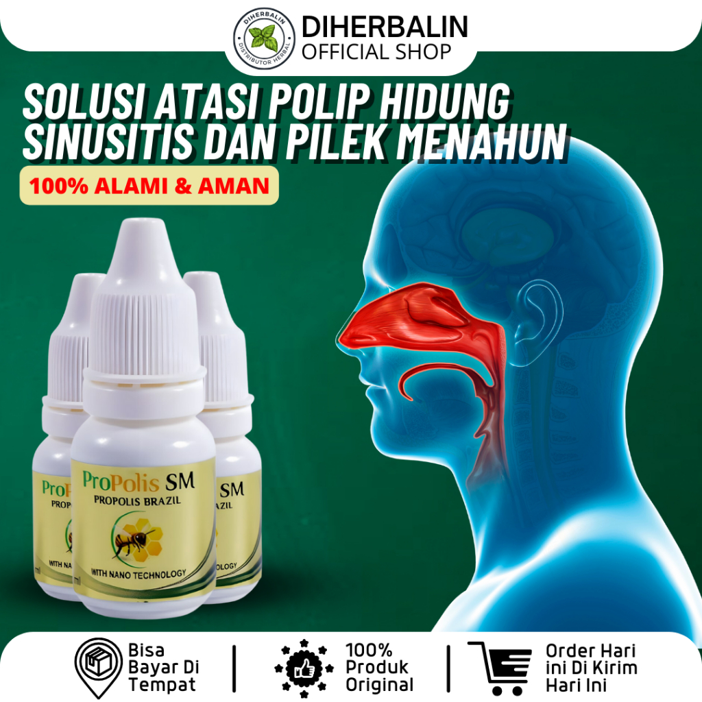 Jual ProPolis SM Obat Sinusitis Polip Hidung Herbal Batur Kering dan Berdahak Sinus Sinusitis ...