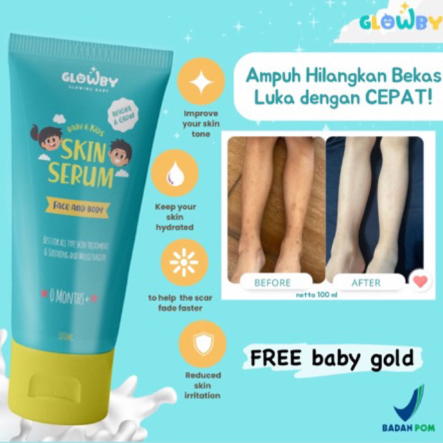 Jual GLOWBY Skin serum pencerah kulit Anak dan bayi 100ML (Ready stock ...