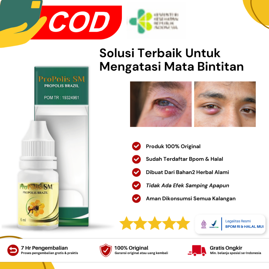 Jual Obat Oles Mata Bintitan Luar, Salep Mata Bintitan, Pengempis ...