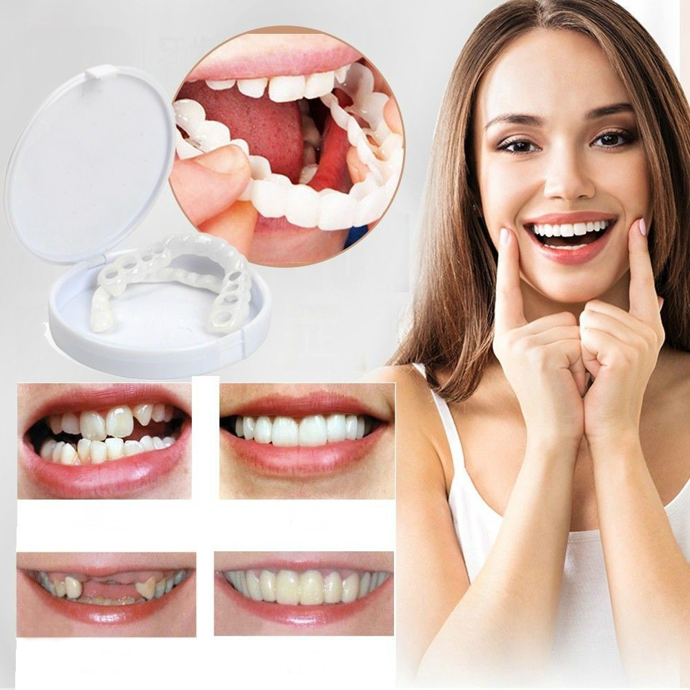 Jual Snap On Smile Original 100% Authentic Gigi Palsu Tiruan 1 Set Gigi ...