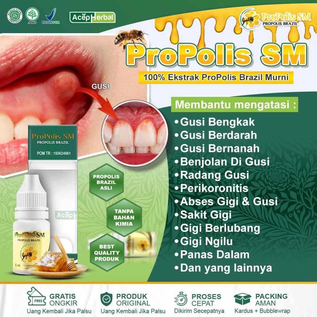 Jual Obat Gusi Bengkak Gusi Berdarah Gusi Bernanah Benjolan Di Gusi ...