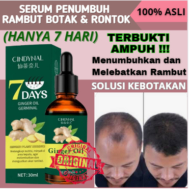 Jual Penumbuh Rambut Botak Dan Rontok Pria Anak Bayi Balita Cepat Serum ...