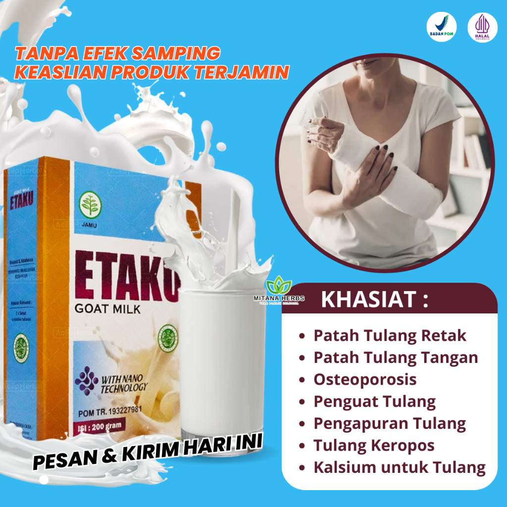 Jual Susu Patah Tulang Dan Retak, Susu Patah Tulang Tangan, Susu ...