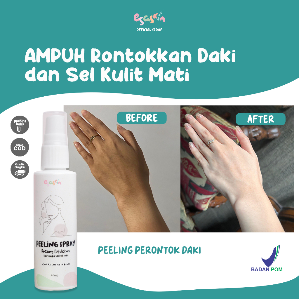 Jual ESASKIN Peeling Spray - Pemula Eksfoliasi Mengangkat sel kulit ...