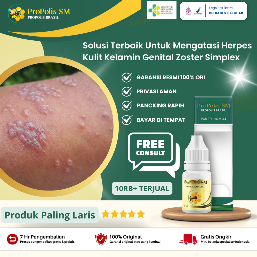 Jual Propolis SM Obat Herpes Kulit Kelamin Genital Zoster Bibir - Isi 6 ...