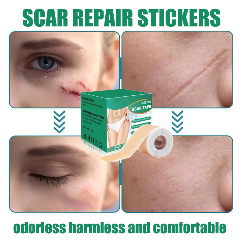 Jual Silicone Scar Sheet plester silikon penghilang keloid bekas luka ...