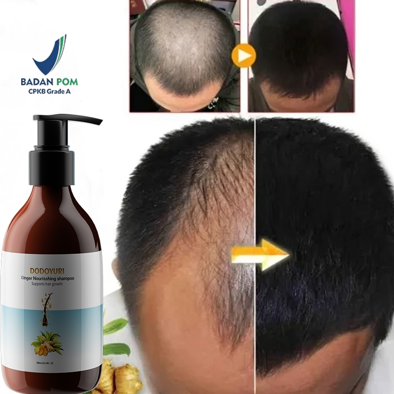 Jual Shampoo rambut rontok sampo penumbuh rambut cepat sampo anti ...