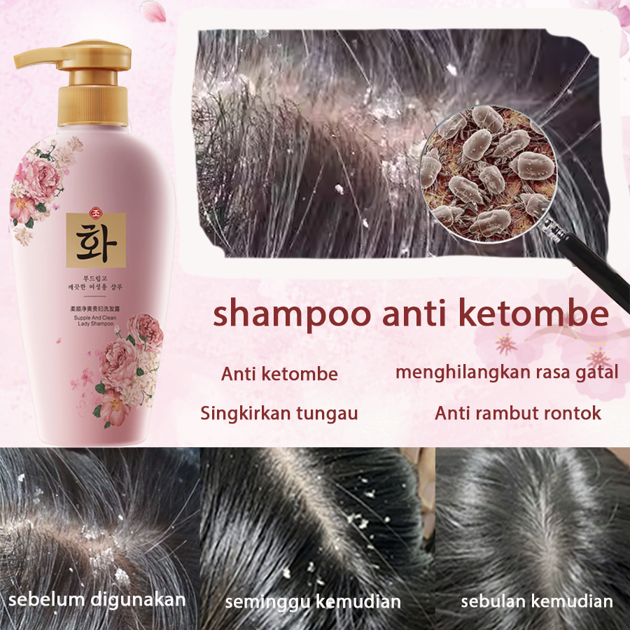 Jual Shampo Anti Ketombe, Shampo Anti Ketombe & Anti Gatal, Memperbaiki Kulit Kepala, Mengontrol ...