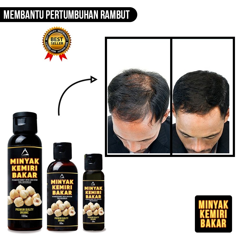 Jual [BPOM] Minyak Kemiri Gold dan Kemiri Bakar 100% Asli - Minyak ...