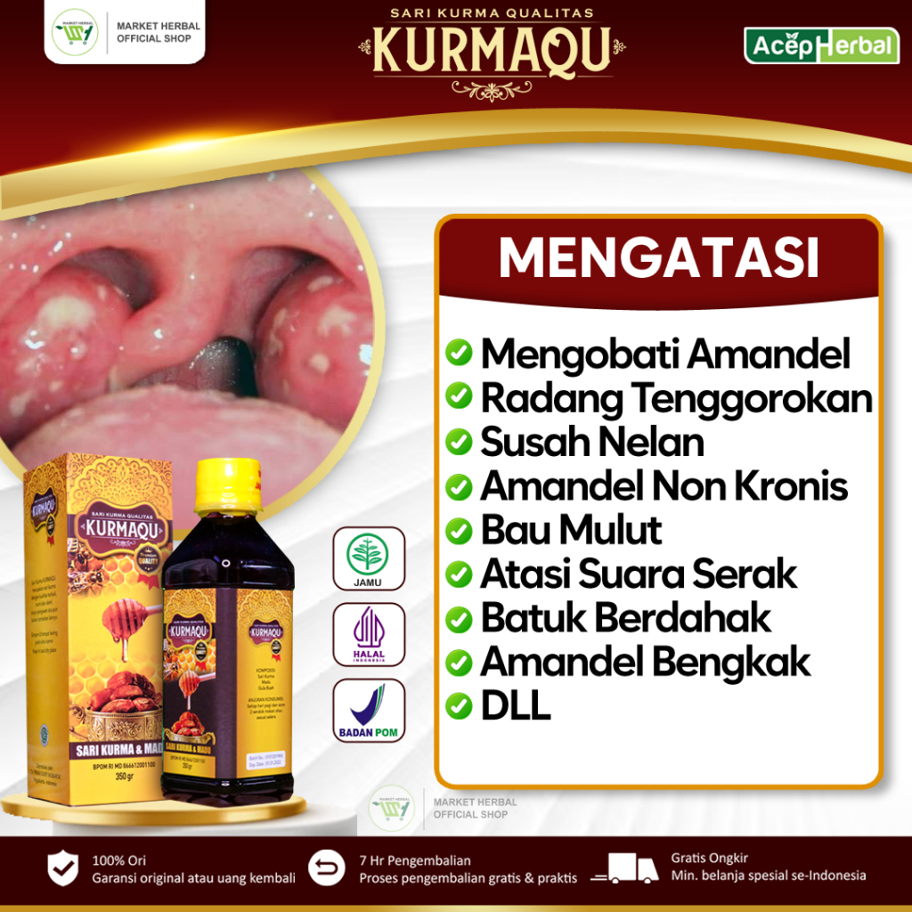 Jual Obat Herbal Amandel Anak dan Dewasa Radang Tenggorokan Susah Nelan ...