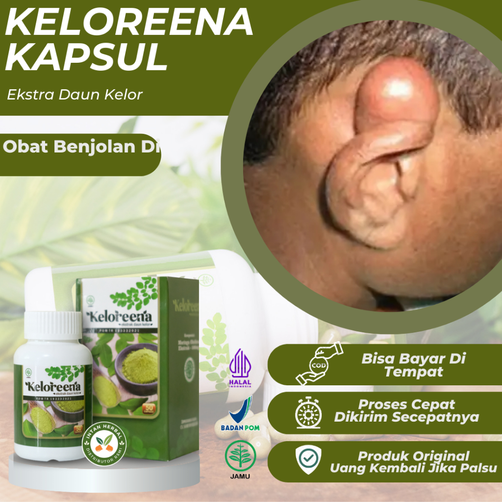 Jual Keloreena Kapsul 100% Original - Obat Benjolan Di Telinga ...