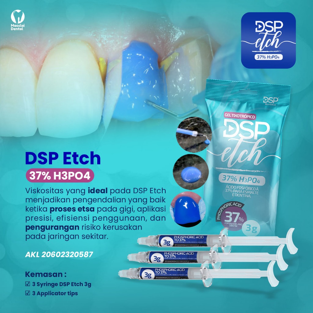 Jual MACCLAI DENTAL ETCHING GEL GIGI / ETSA ETCHA DSP ETCH REGISTRASI AKL / ANY ETCH | Shopee ...