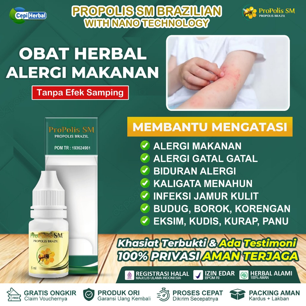 Jual Obat Untuk Alergi Makanan cumi udang telur kacang kepiting Sabun ...