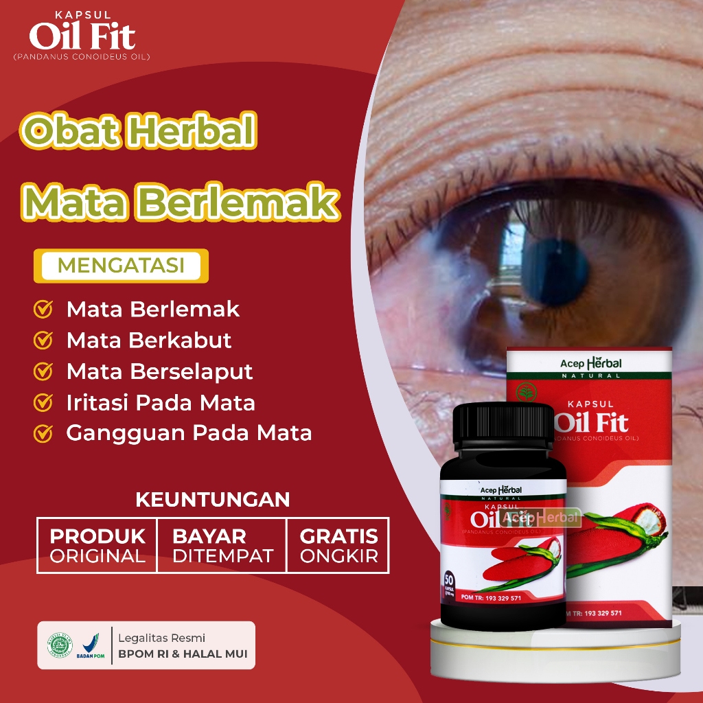 Jual Obat Mata Berlemak Pterygium Mata Berselaput Glukoma Katarak ...