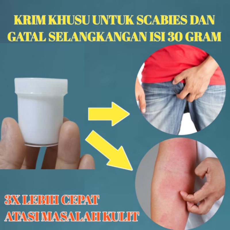 Jual Salep serbaguna racikan apotek isi 20 gram paling ampuh untuk ...