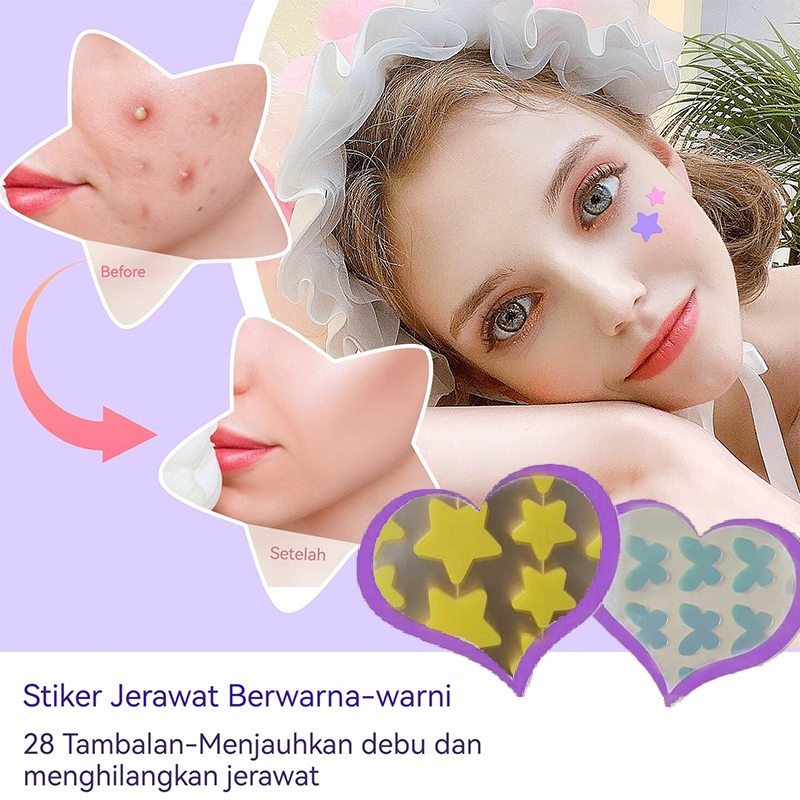 Jual Acne Patch Pimple Patch Stiker Jerawat Berwarna-Warni Cute Star ...