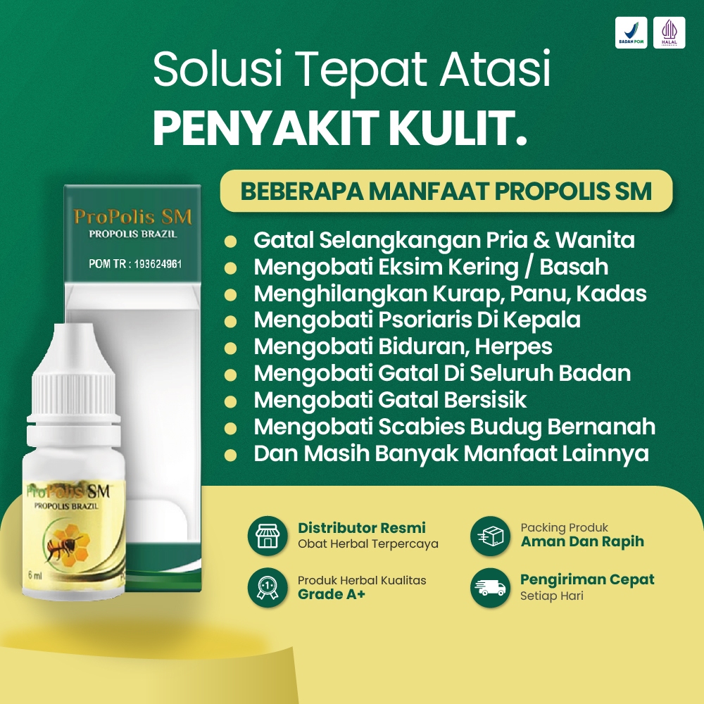 Jual Obat Gatal Kulit Salep Eksim Exim Psoriasis Kepala Borok Infeksi ...