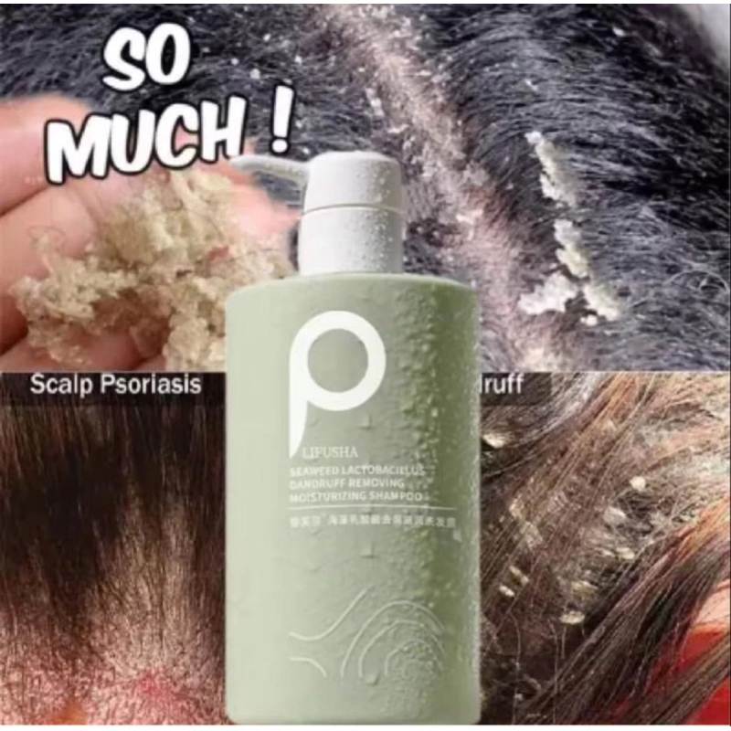 Jual SHAMPO ANTI KETOMBE LIFUSHA / SEA SALT | Shopee Indonesia