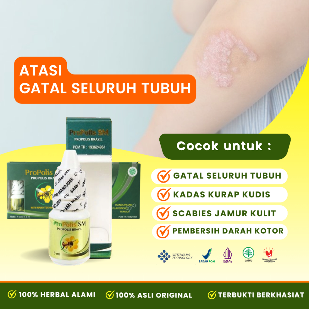 Jual Obat Gatal Seluruh Badan, Gatal Menahun, Kadas Kurap Kudis Scabies ...
