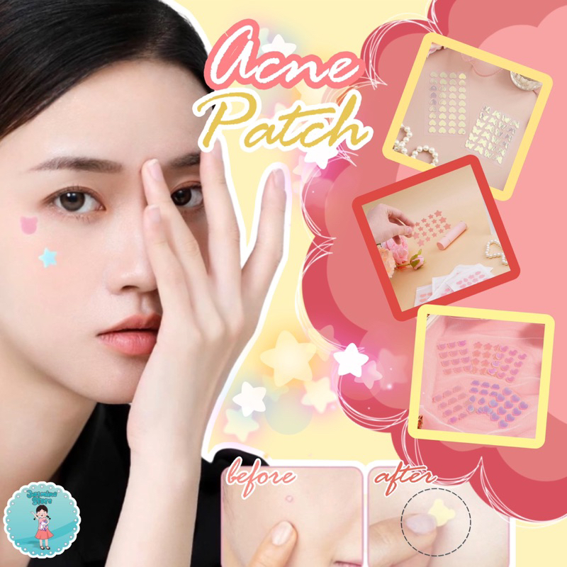 Jual Stiker Jerawat Hydrocolloid Acne Patch Colourfull Lets Glow Group ...