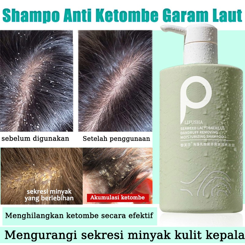 Jual Shampo buat ketombe penghilang anti gatal pengobatan tungau amino memperbaiki rambut 500ML ...