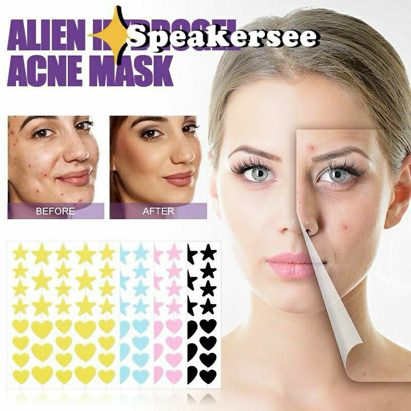 Jual Acne Patch Jerawat Pimple Patch Repsir Skin Acne Pimple Masker ...