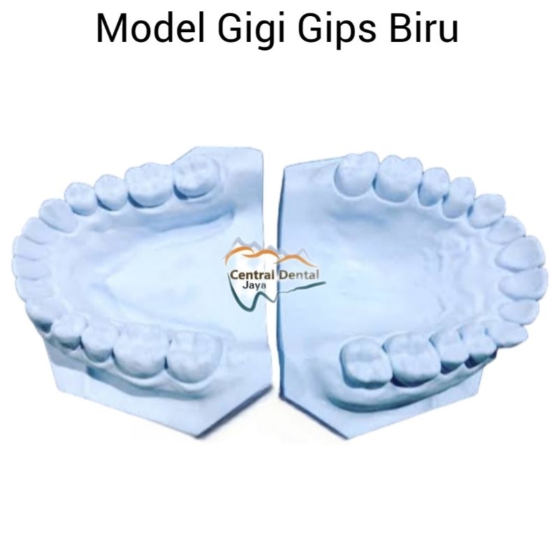 Jual Model Gigi Gips Biru Full M2 High Quality / Dental Model Study ...