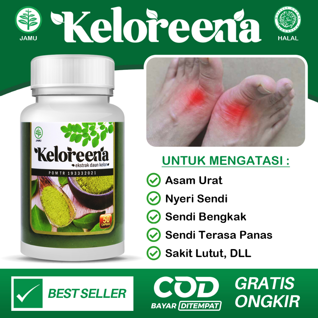 Jual Obat Asam Urat Nyeri Sendi Tangan Kaki Bengkak Rematik Sakit Kaki ...
