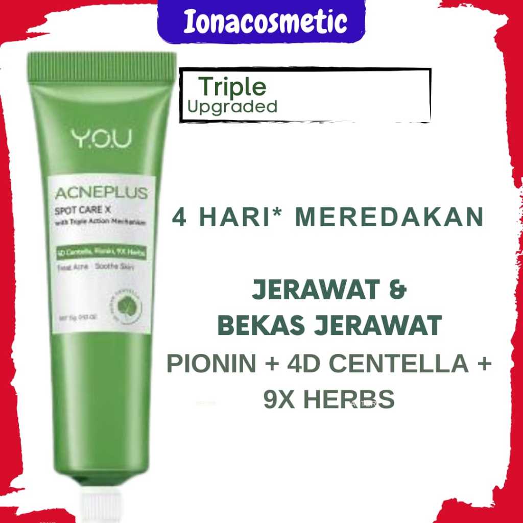 Jual [NEW UPGRADED] YOU AcnePlus Spot Care X | Obat Totol Jerawat ...