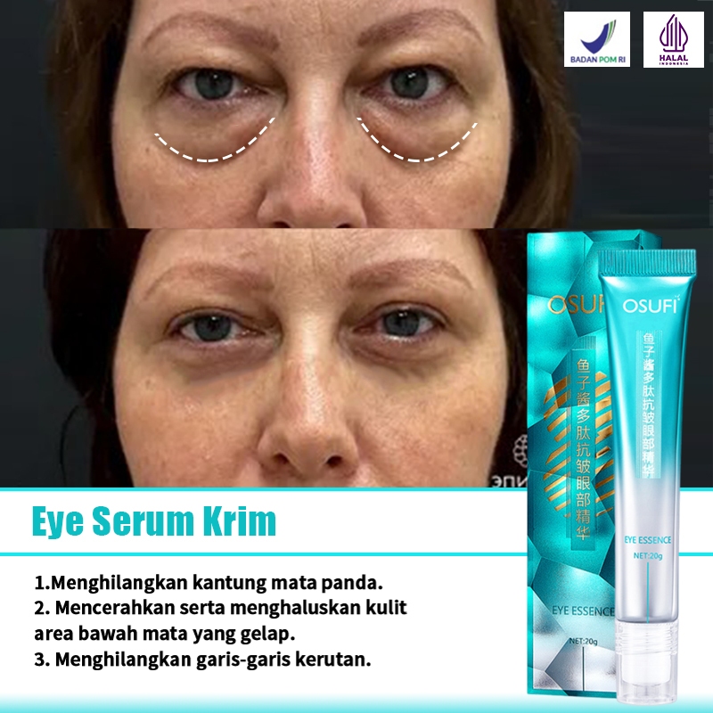 Jual Eye cream Penghilang mata panda Cream mata panda Serum mata panda ...