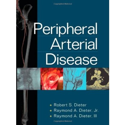 Jual Peripheral Arterial Disease | Shopee Indonesia