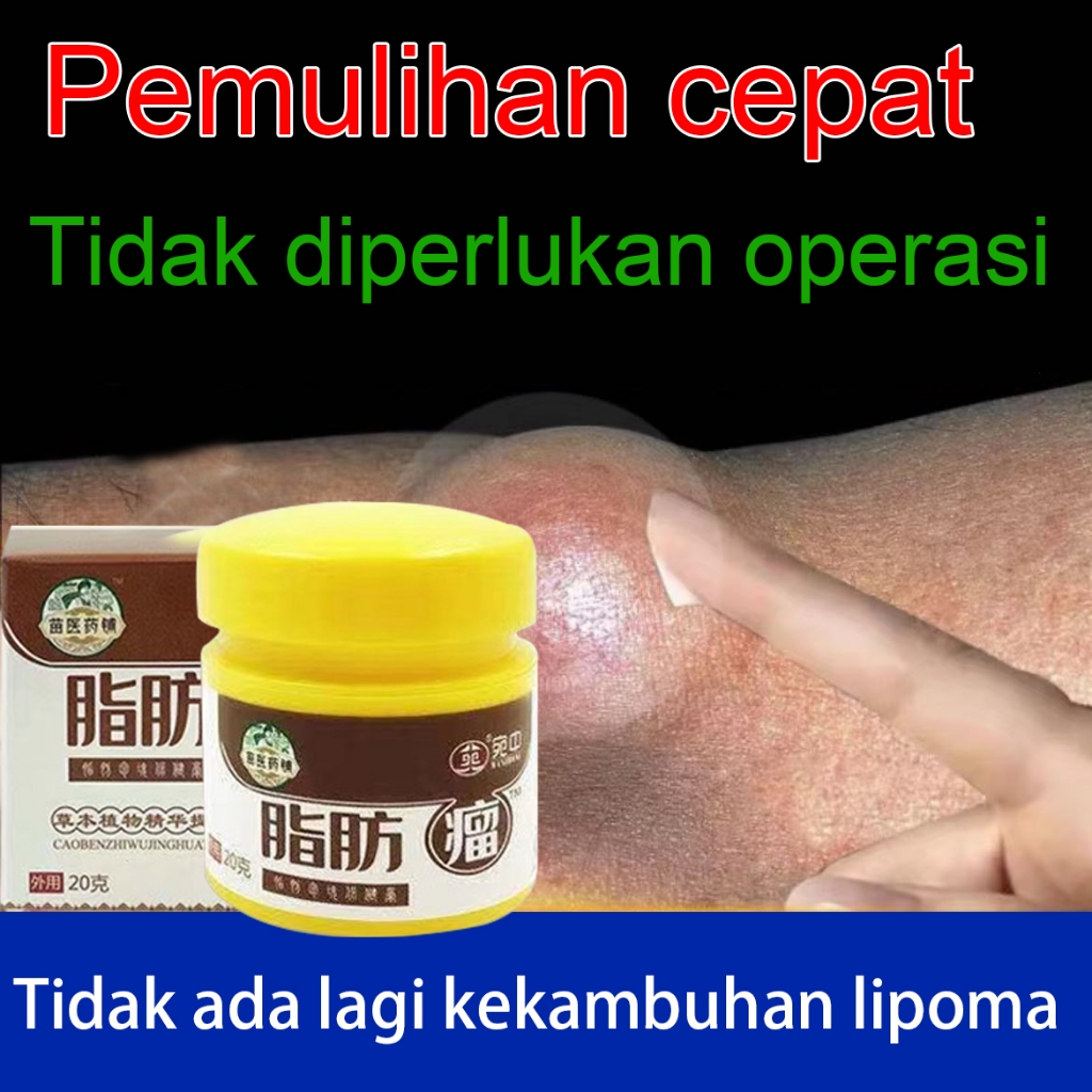 Jual lipoma cream original Salep Obat Cream Lipoma Penghilang Lemak ...