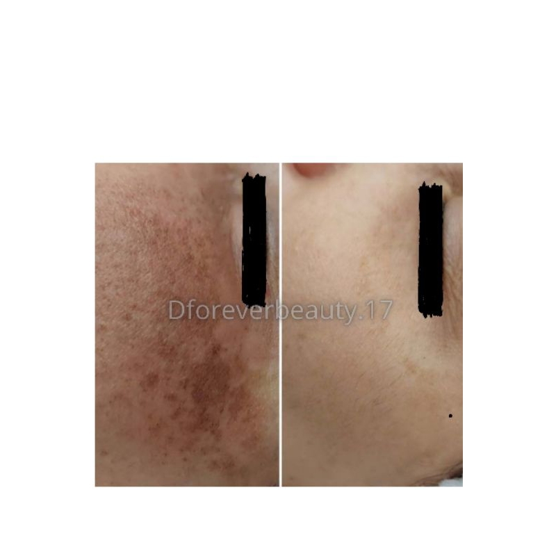 Jual BISA/COD//PAKET CREAM FLEK HITAM MEMBANDEL/KULIT SUSAH PUTIH/CERAH ...