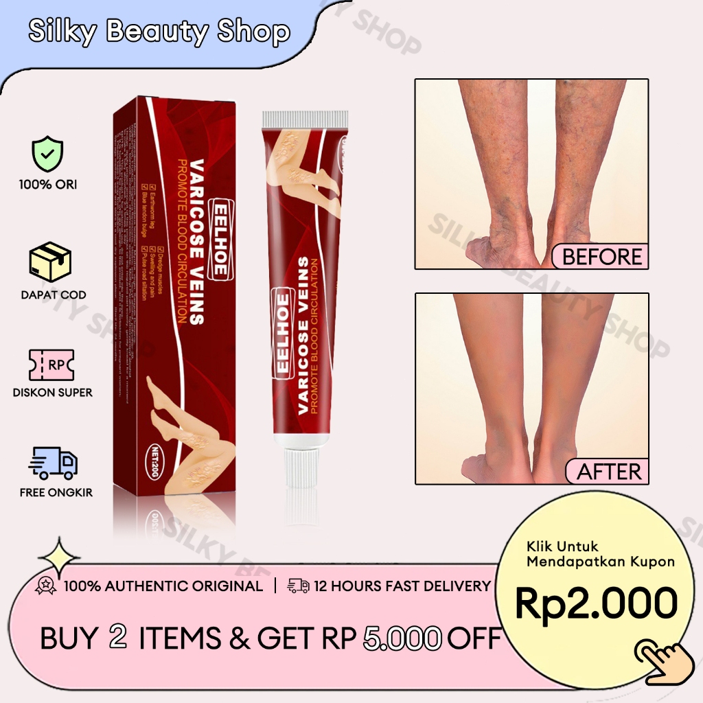 Jual EELHOE 【Beli 3 Gratis 2】Varicose Veins Cream 20g Varicose Veins ...